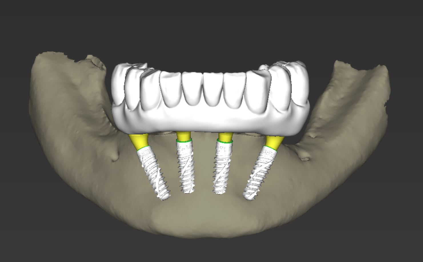 Notre activité – TEETH PROJECT