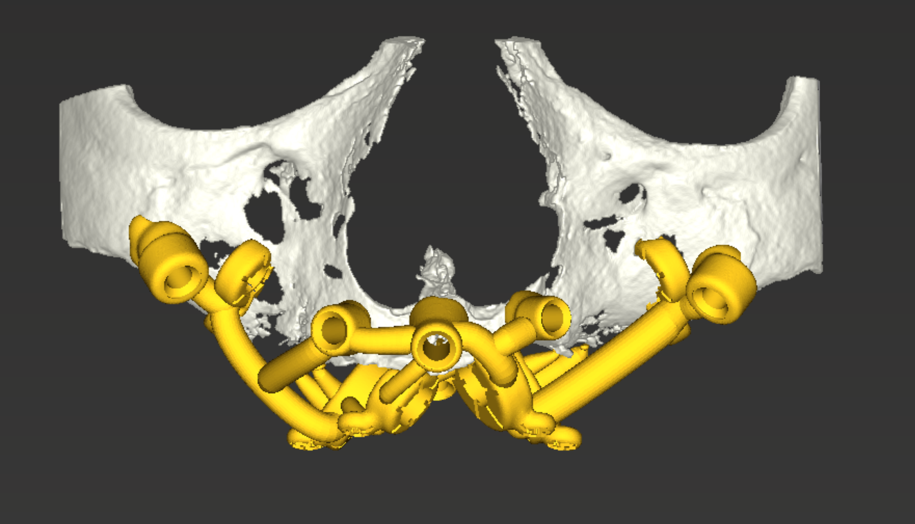 Notre activité – TEETH PROJECT