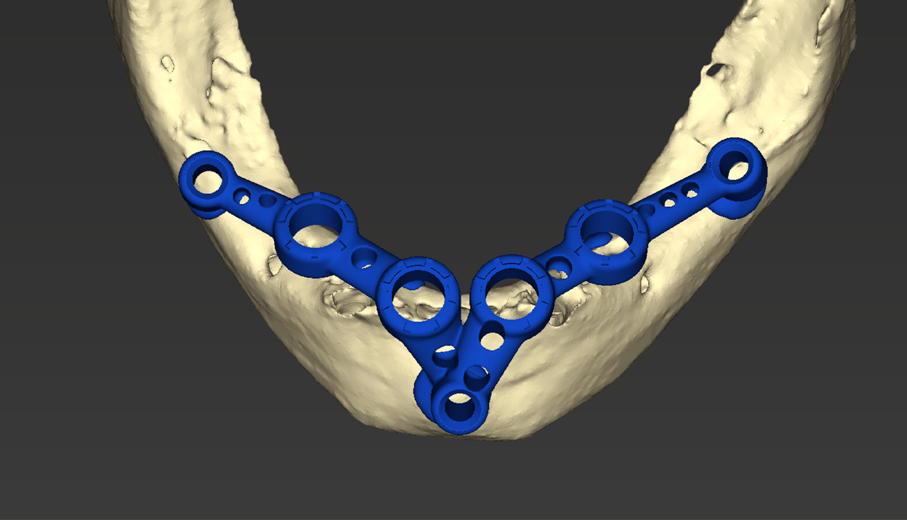 Notre activité – TEETH PROJECT