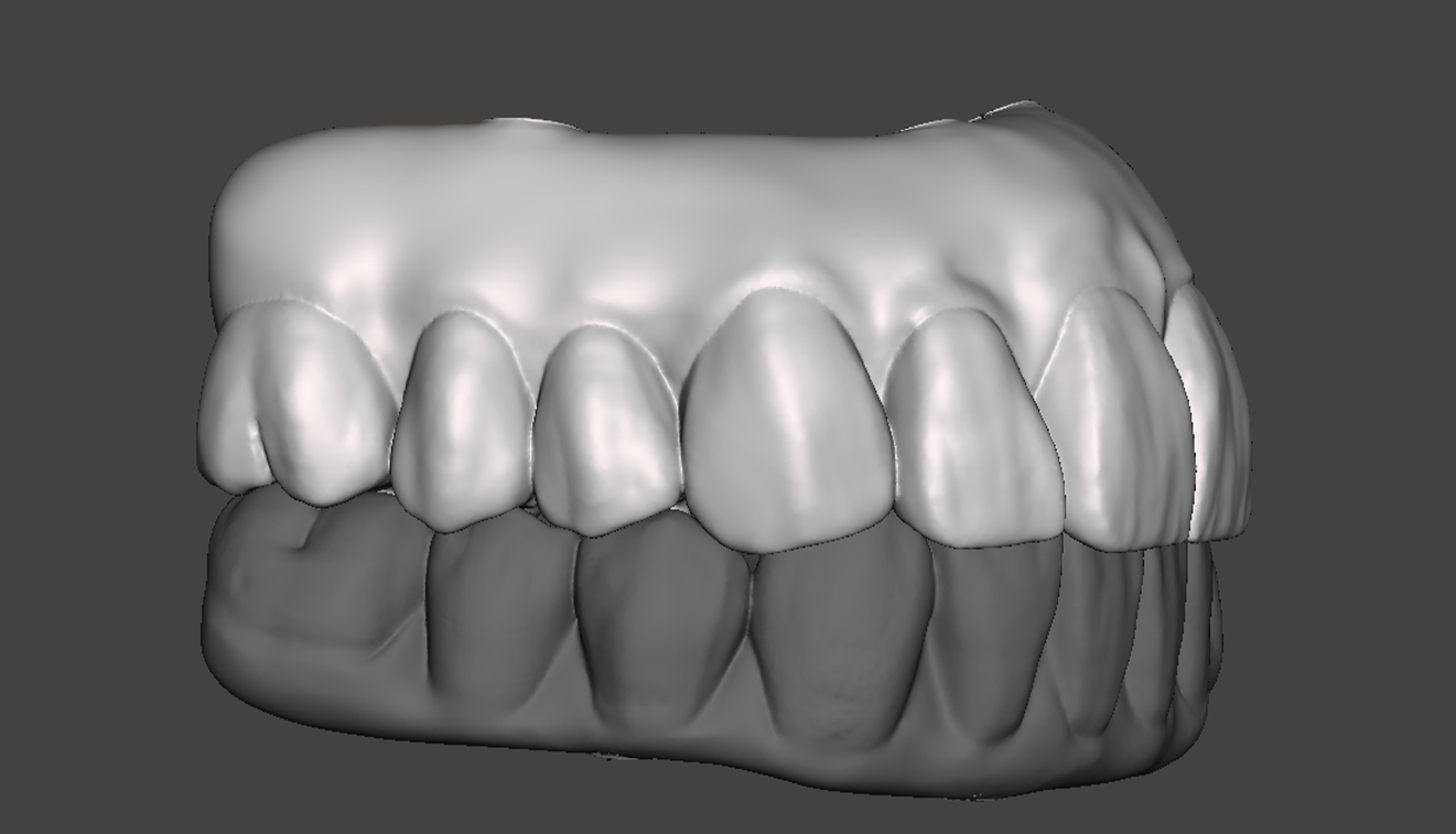Notre activité – TEETH PROJECT